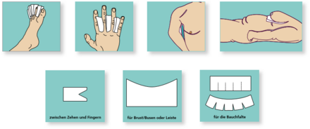 Summer time is intertrigo time - Ligamed medical Products GmbH